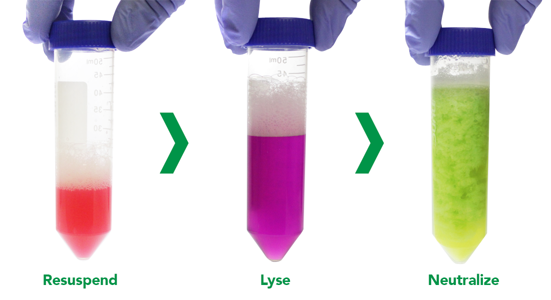 ZymoPURE II Plasmid Prep Kits | Zymoresearch